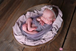 Zoey – Alexxus Imaging